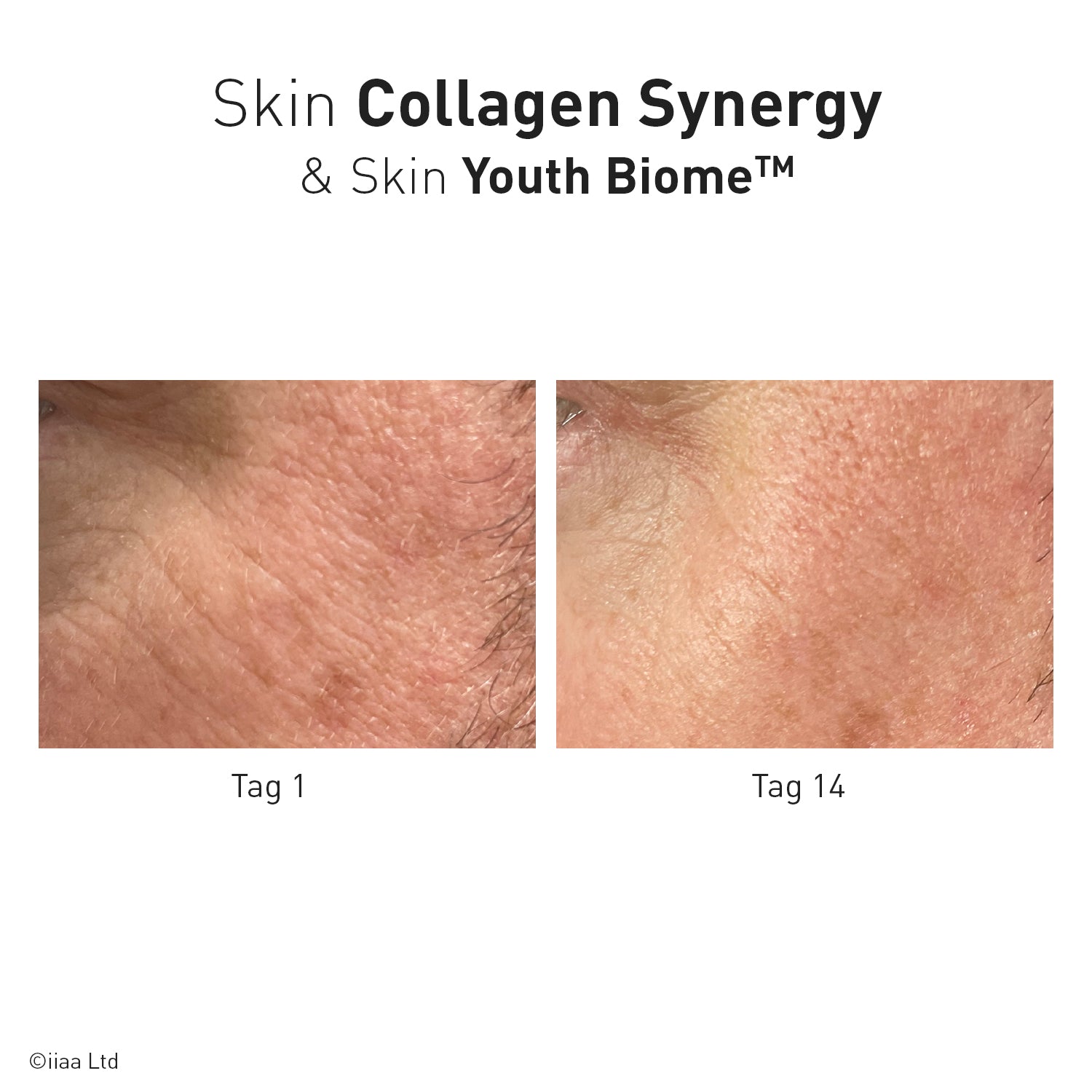 Advanced Nutrition Programme - Skin Collagen Synergy – ZEITWUNDER ...
